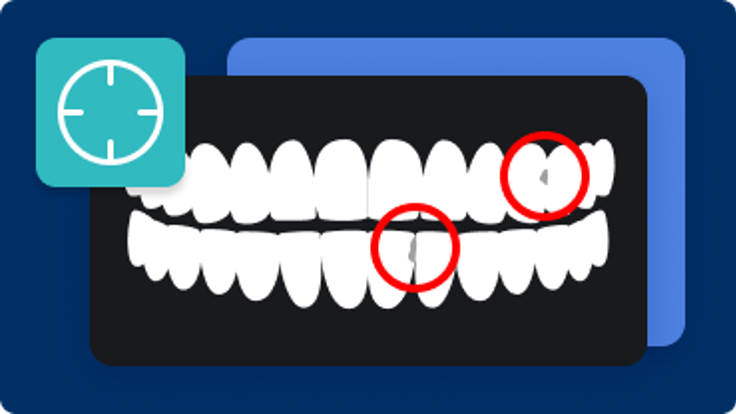 Dentrix Enhances Diagnostic Accuracy with FDA Cleared AI | Dentrix